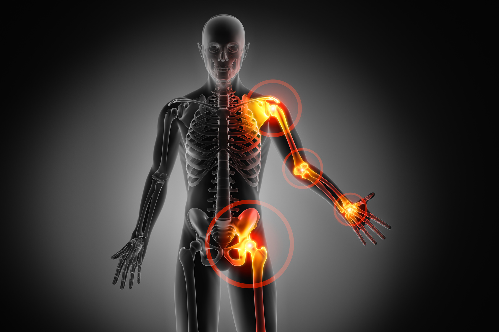 Reumatyzm - Masaż, Fizjoterapia, Rehabilitacja - Szymon Budnik